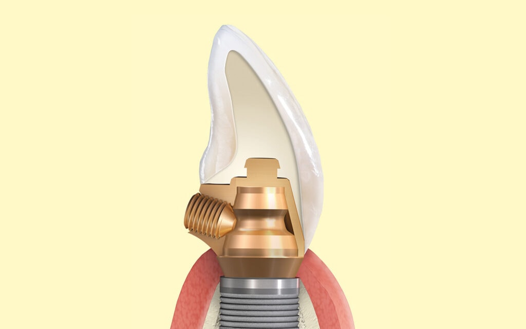 bredent | bredent group GmbH & Co.KG