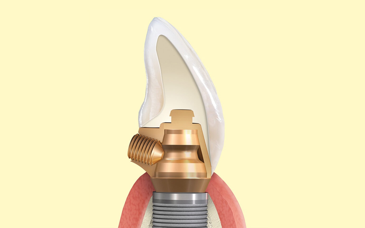 bredent | bredent group GmbH & Co.KG