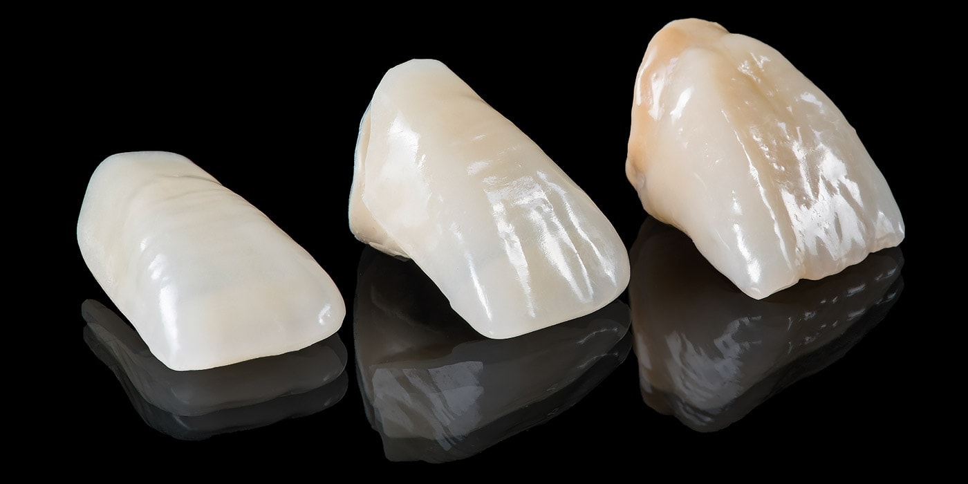 novo.lign & BioHPP - Register | bredent group GmbH & Co.KG