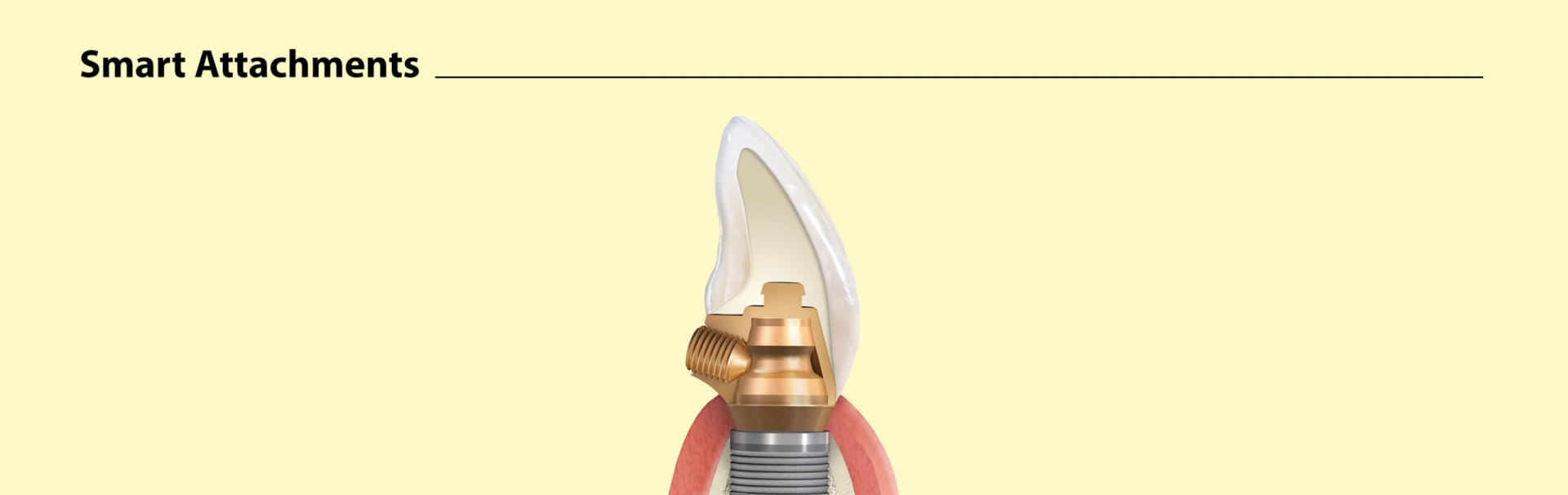 bredent group GmbH & Co.KG | We are One