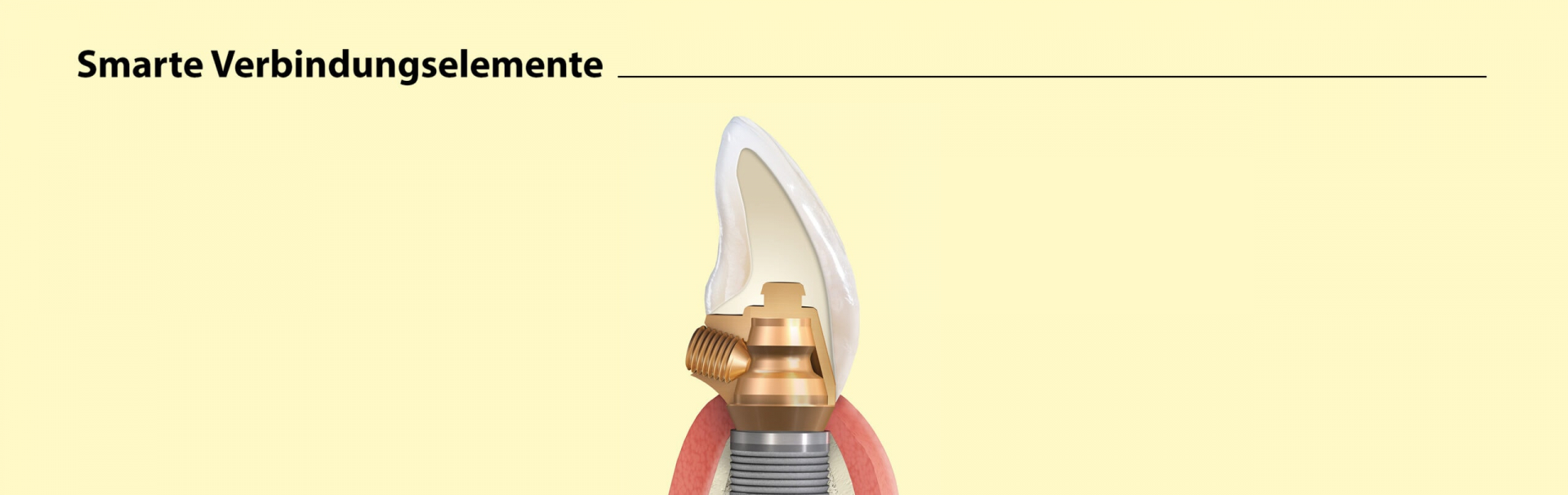 bredent group GmbH & Co.KG | We are One